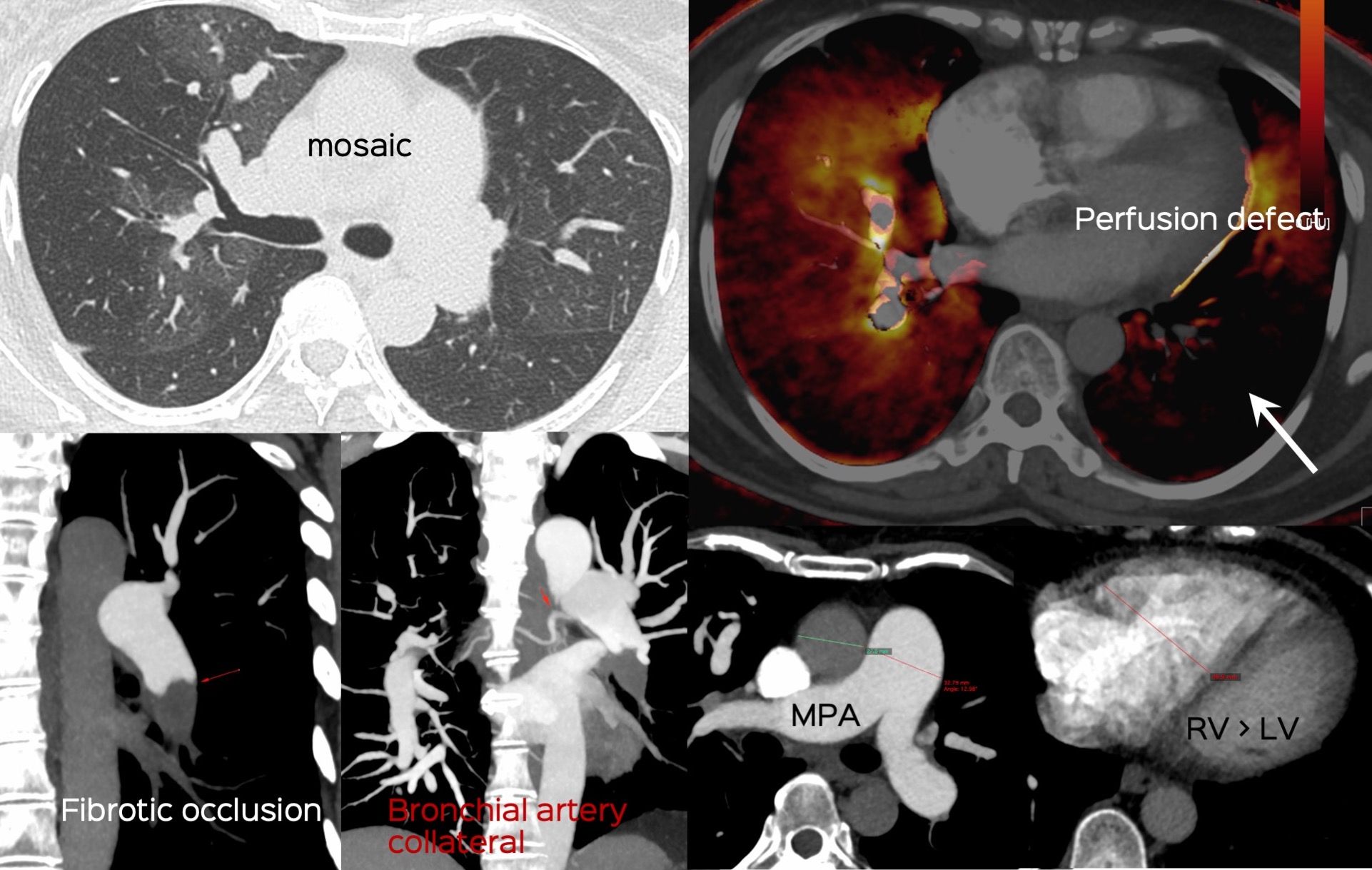 Case 24 Cteph