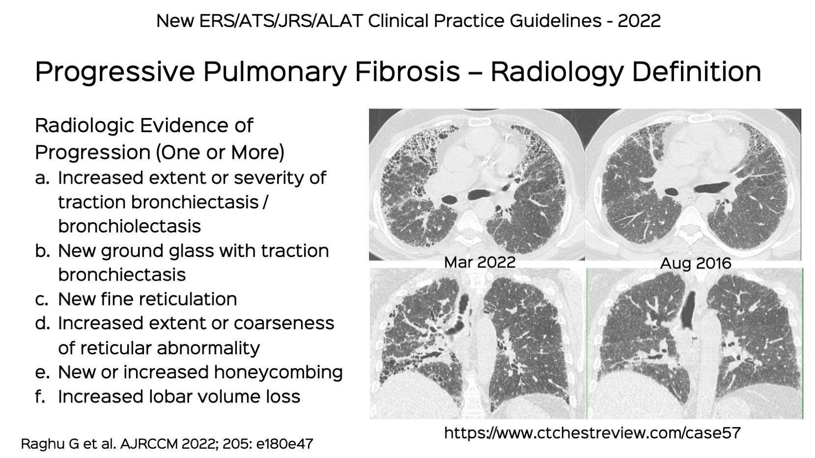 case-57-progressive-pulmonary-fibrosis-the-2022-ats-ers-jrs-alat