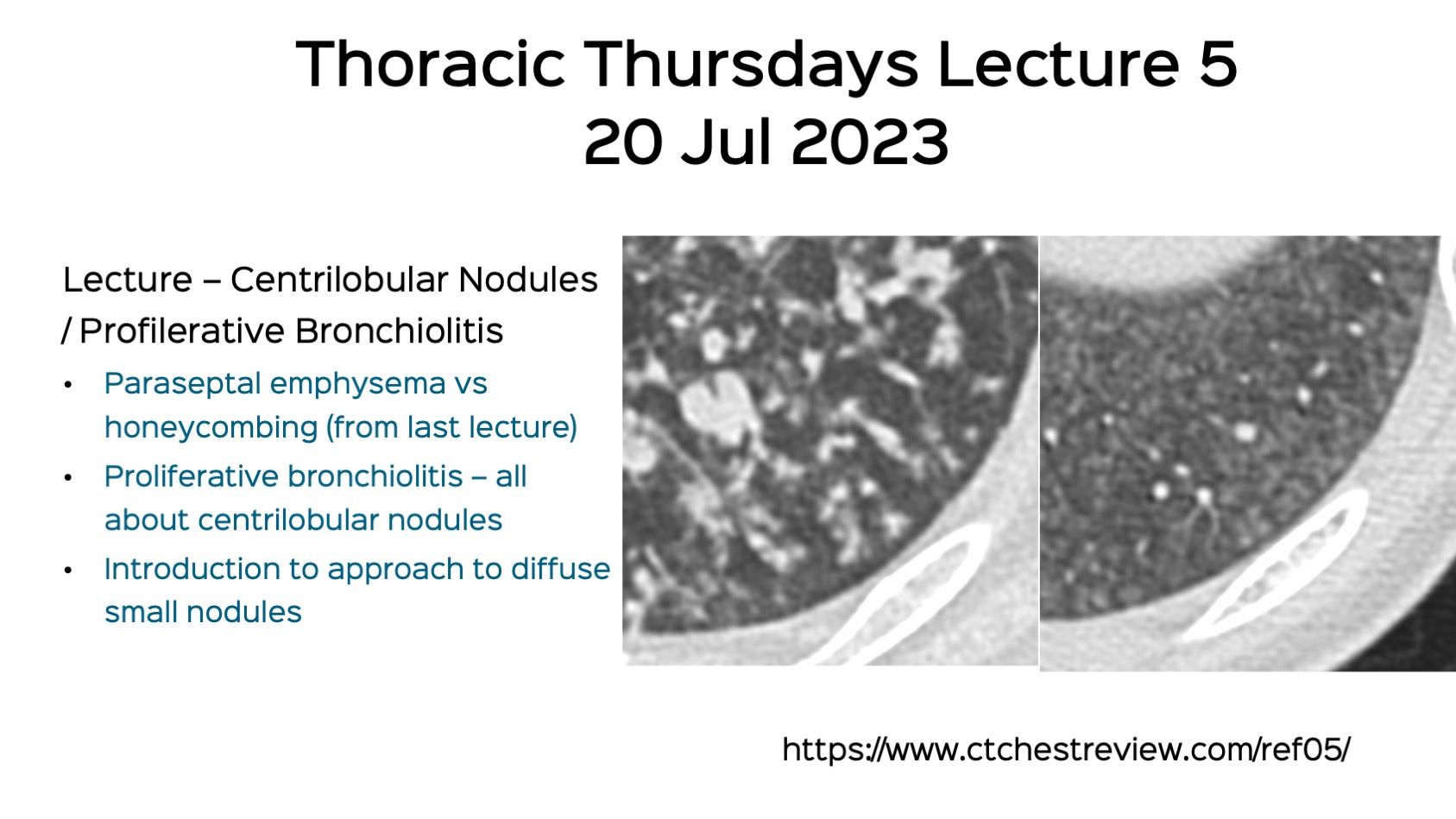 REF-Cafe Roentgen Thoracic Thursday Lecture - V - 20th July 2023: All ...