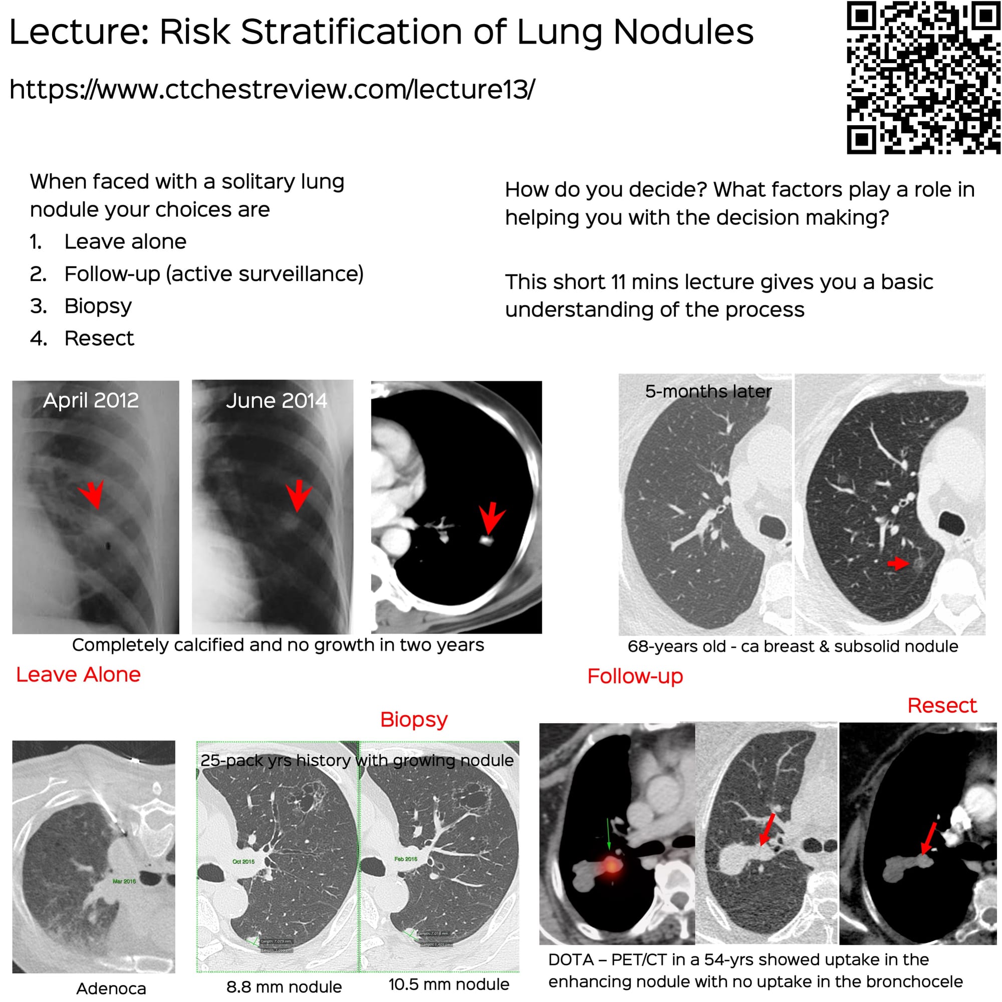 Lecture: Risk Stratification of Lung Nodules