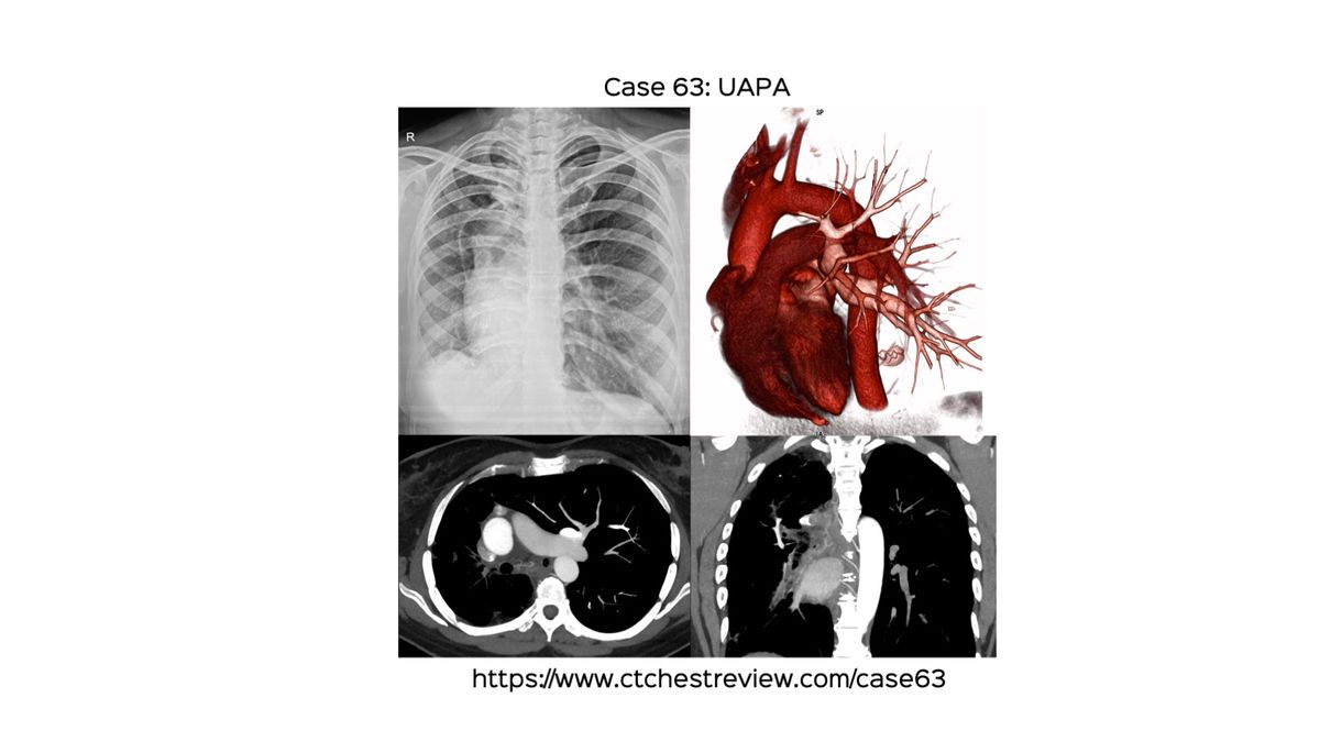 Case 63: UAPA