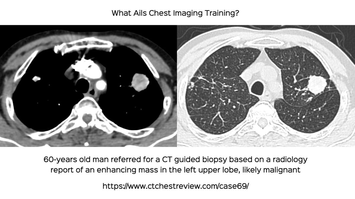 Case 69: What Ails Chest Imaging Training?