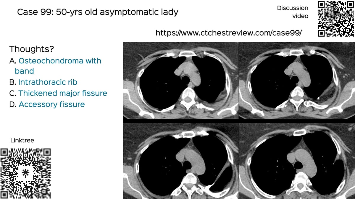 Case 99: A Cleft Lung Puzzle