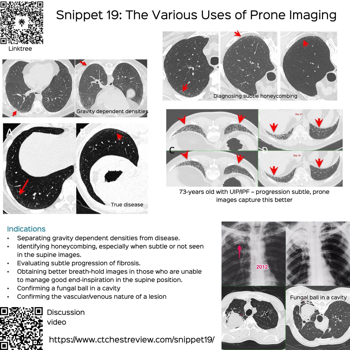 Snippet 19: The Various Uses of Prone Imaging