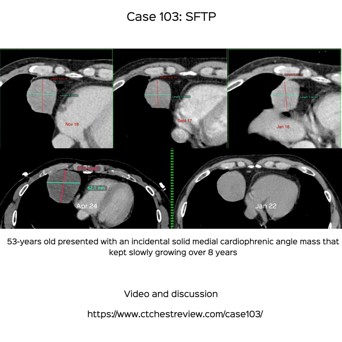 Case 103: SFTP
