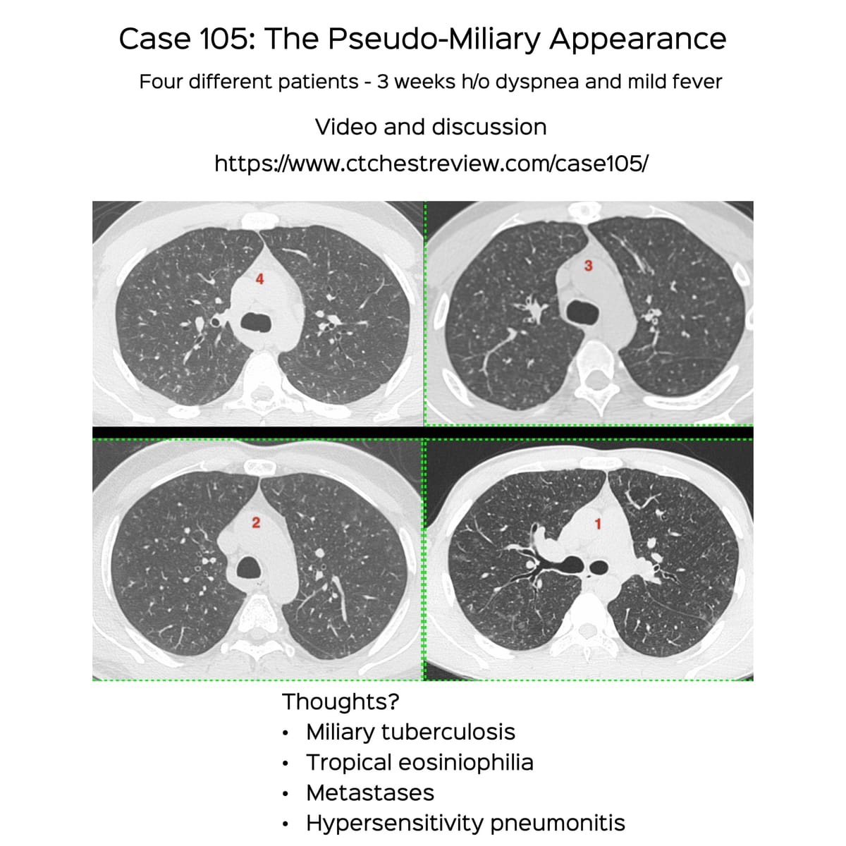 Case 105: The Pseudo-Miliary Appearance