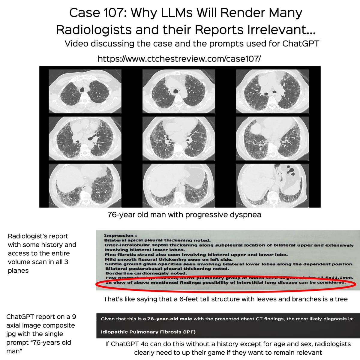 Case 107: Why LLMs Will Render Many Radiologists and their Reports Irrelevant…