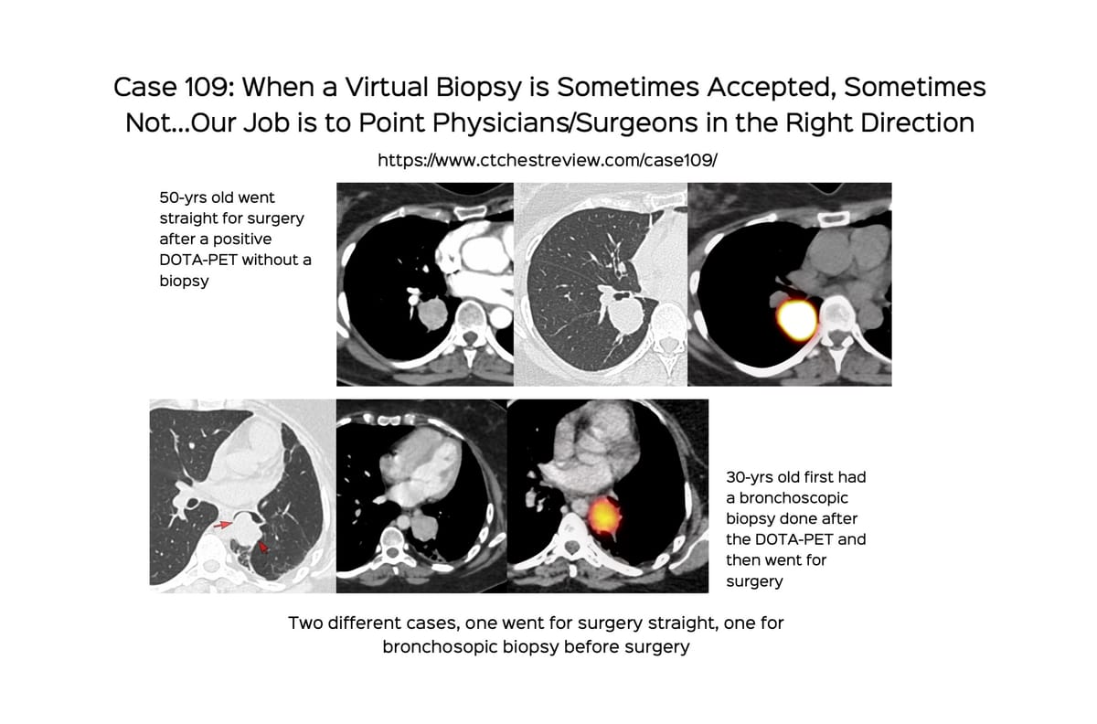 Case 109: When a Virtual Biopsy is Sometimes Accepted, Sometimes Not…Our Job is to Point ...