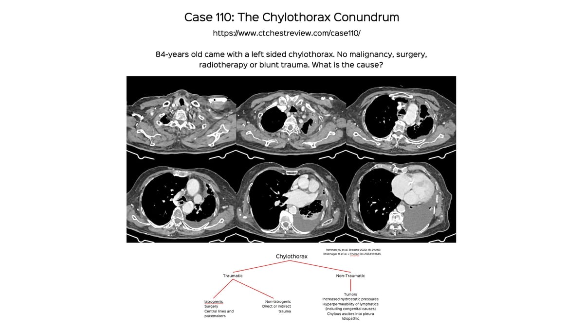 Case 110: The Chylothorax Conundrum