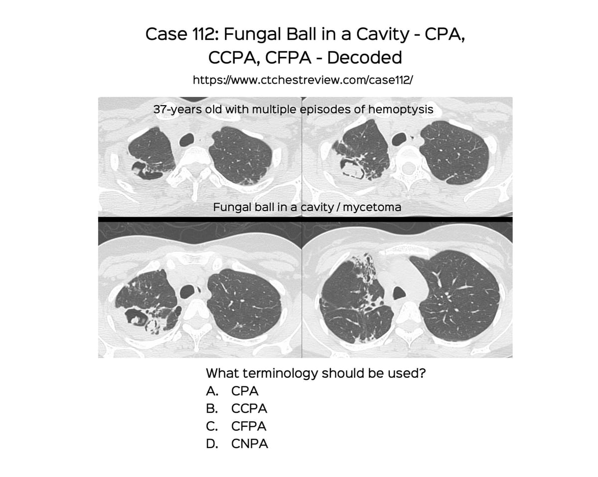 Case 112: Fungal Ball in a Cavity - CPA, CCPA, CFPA - Decoded