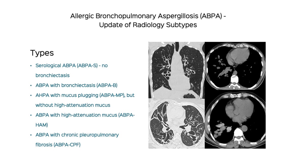 Snippet 23: Allergic Bronchopulmonary Aspergillosis (ABPA) - Update of ...