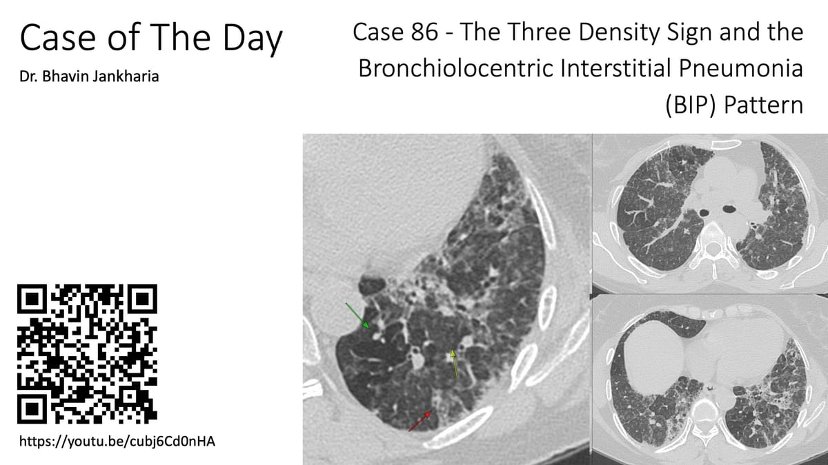 Case of the Day - 086 - 2025 08 13 - Three Density Sign and the ...