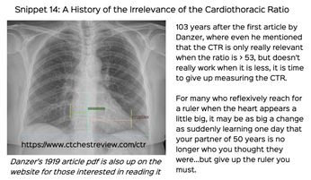 Cardiothoracic Ratio - CT Chest Review