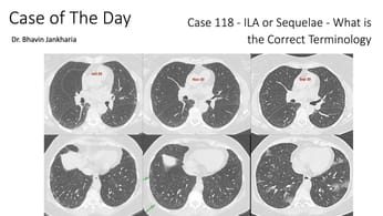COD 118 - ILA of Sequelae - What is the Correct Terminology?