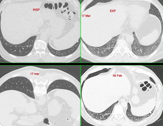 Scan Protocol - CT Chest Review