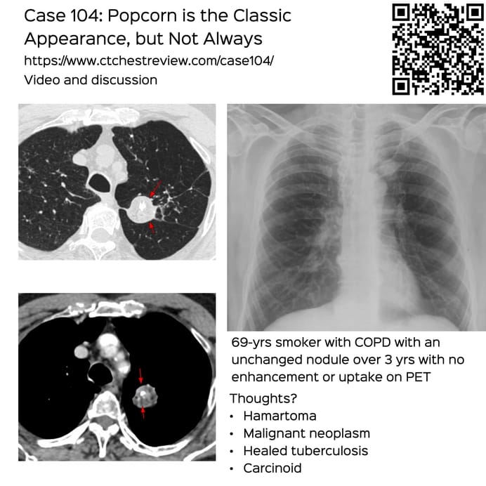 Case 104: Popcorn is the Classic Appearance, but Not Always