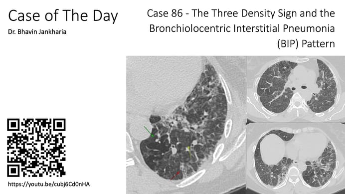 Case of the Day - 086 - 2025 08 13 - Three Density Sign and the ...